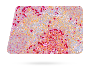 Visualize and Quantify Oligonucleotide Therapy Delivery, Spatial ...