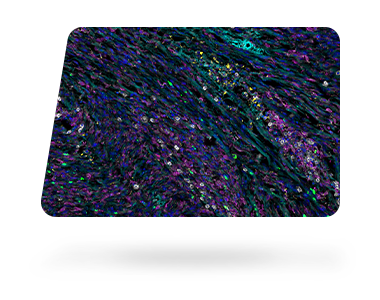 RNAscope spatial profile – RNA markers in obesity | ACDbio